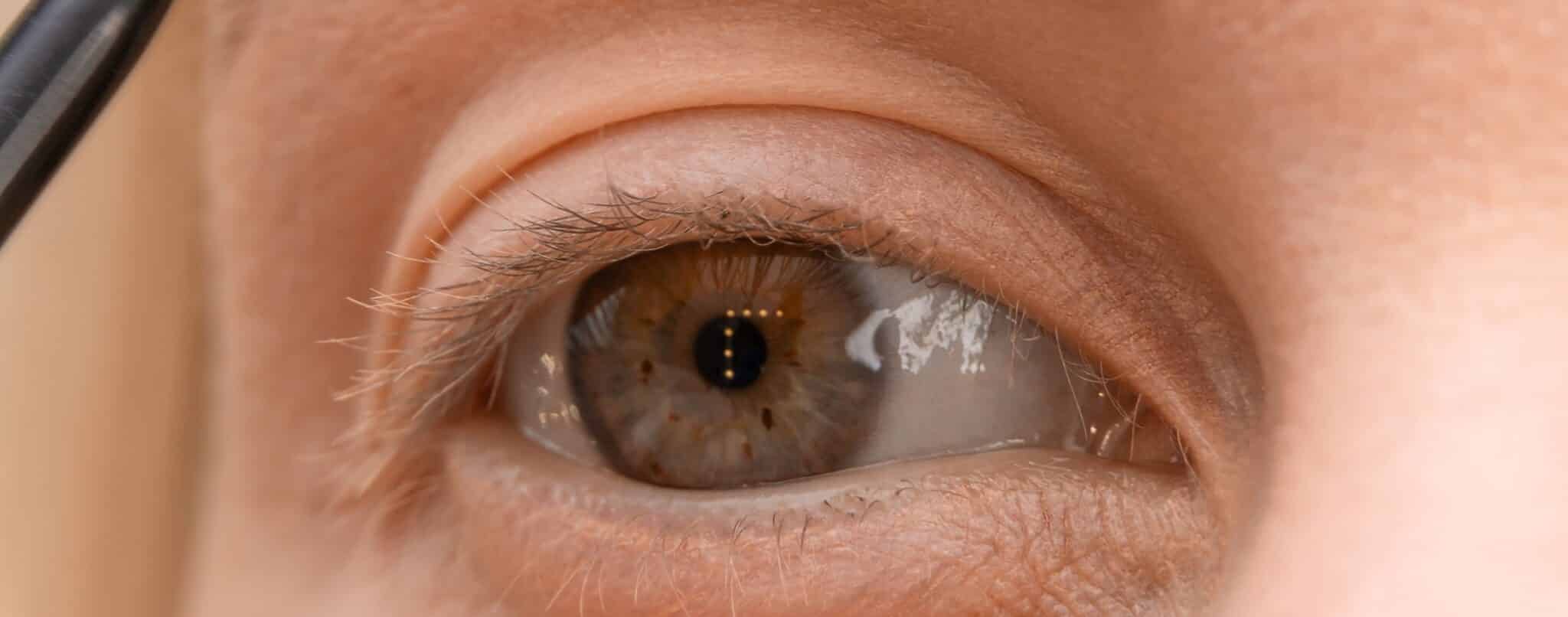 Décollement de rétine : signes d’alerte et urgences médicales | Dr ...